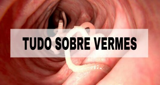 VERMES SINTOMAS CAUSAS TRAMENTOS E (PROTOCOLOS) - Dra Sandra Chagas