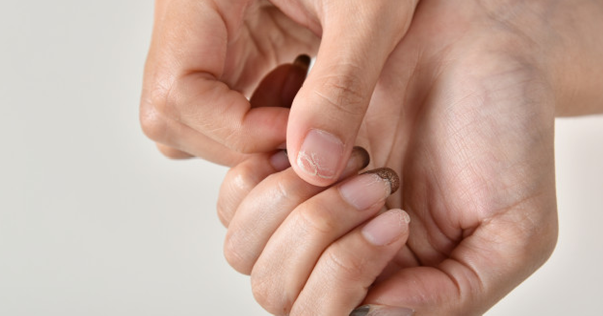 UNHAS, PRINCIPAIS DOENÇAS - Dra Sandra Chagas